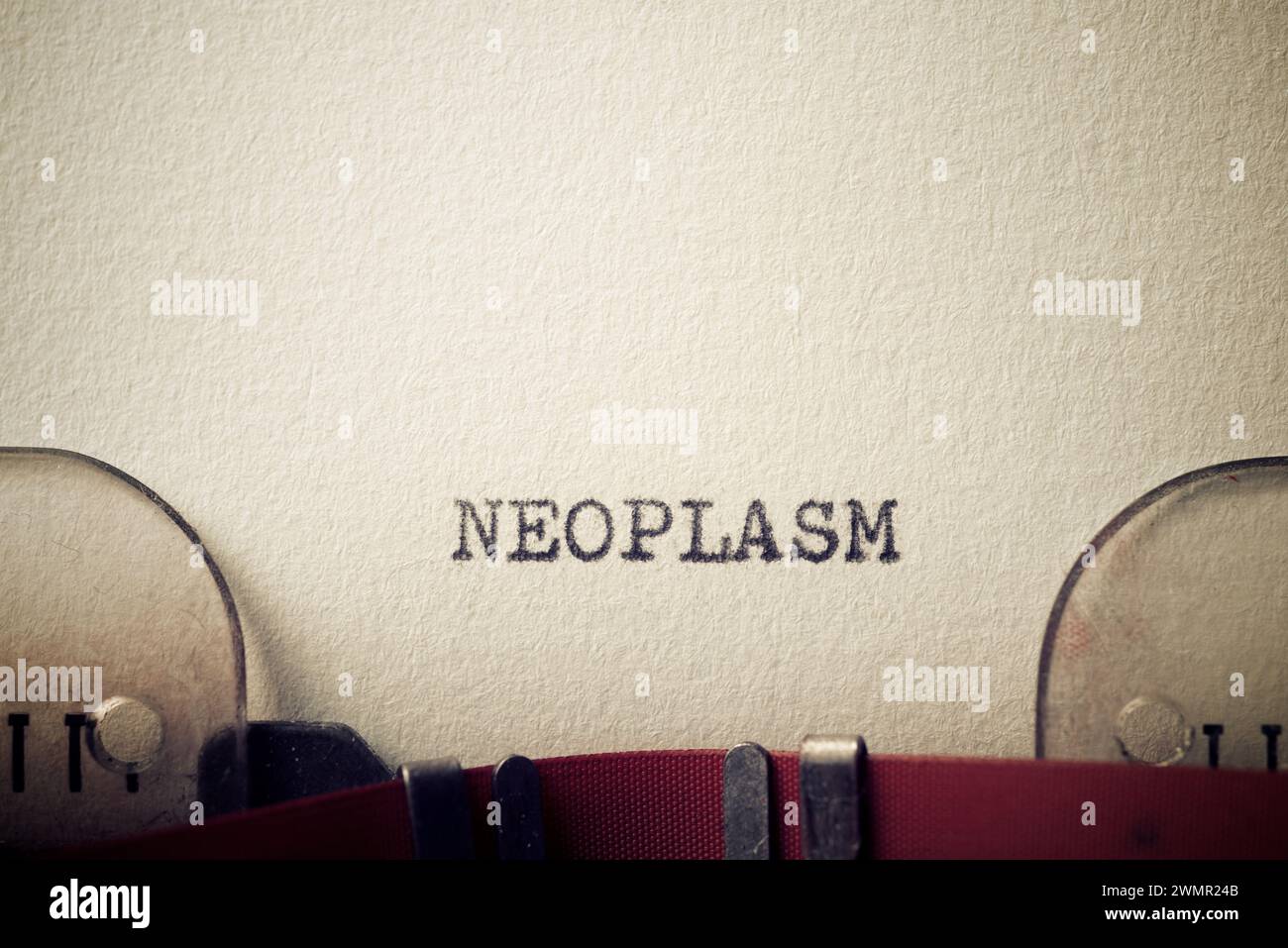 Neoplasm hi-res stock photography and images - Alamy