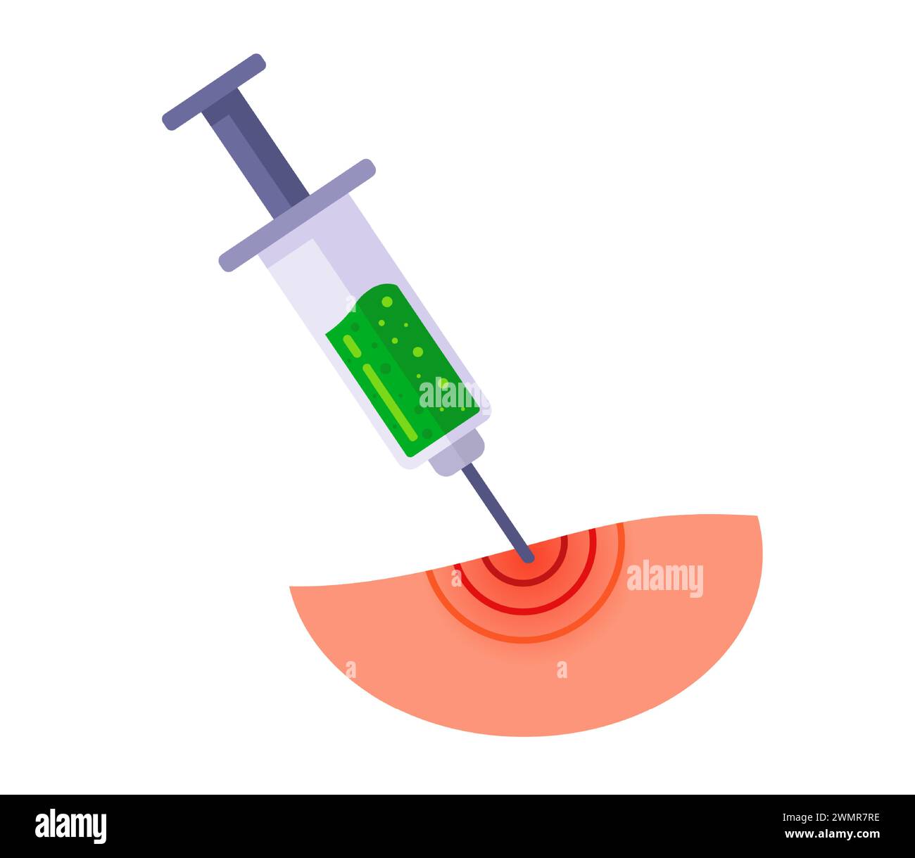 injection with a syringe into a person sore area. flat vector ...