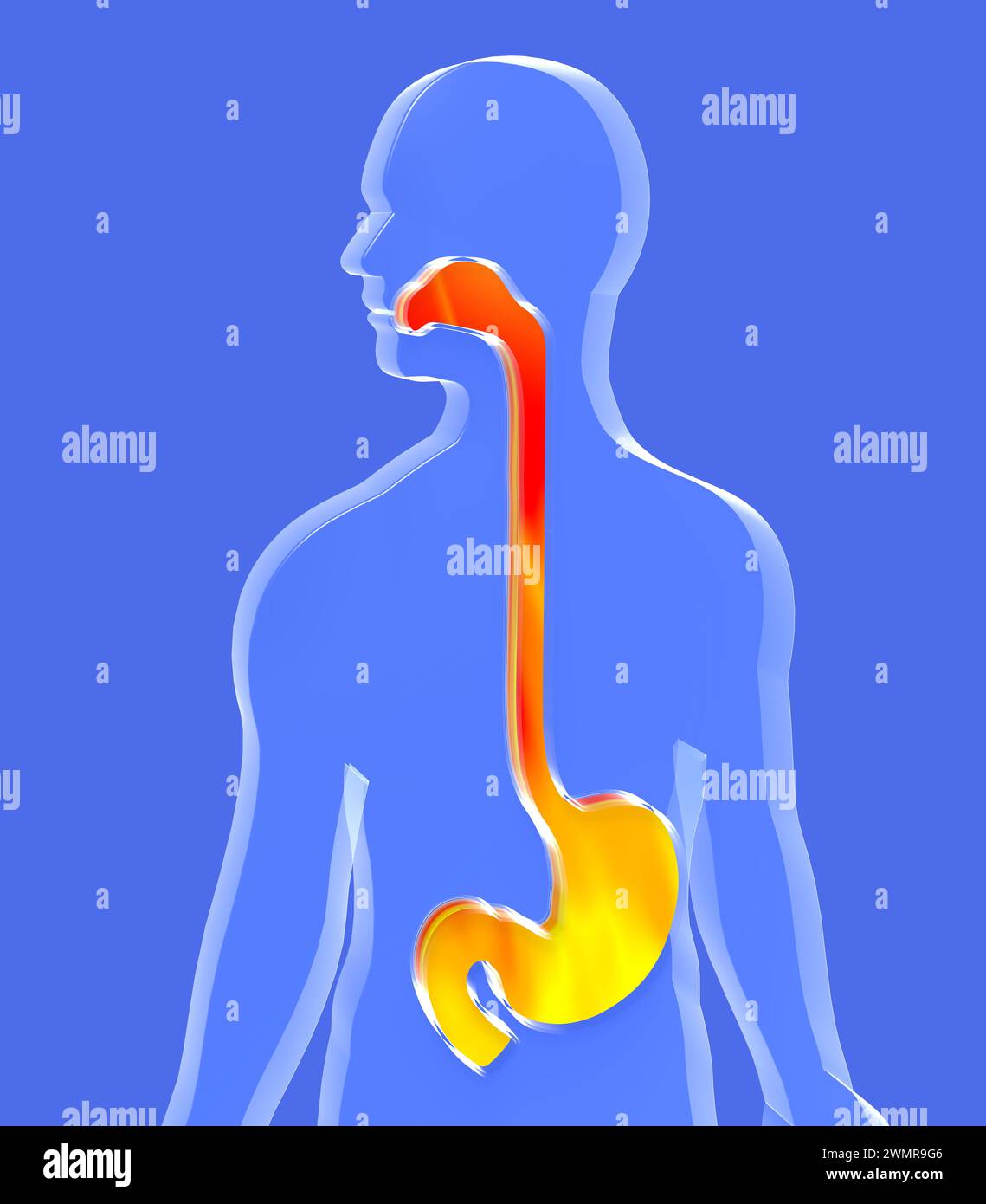 3d illustration of stomach and esophagus to the mouth with indigestion ...