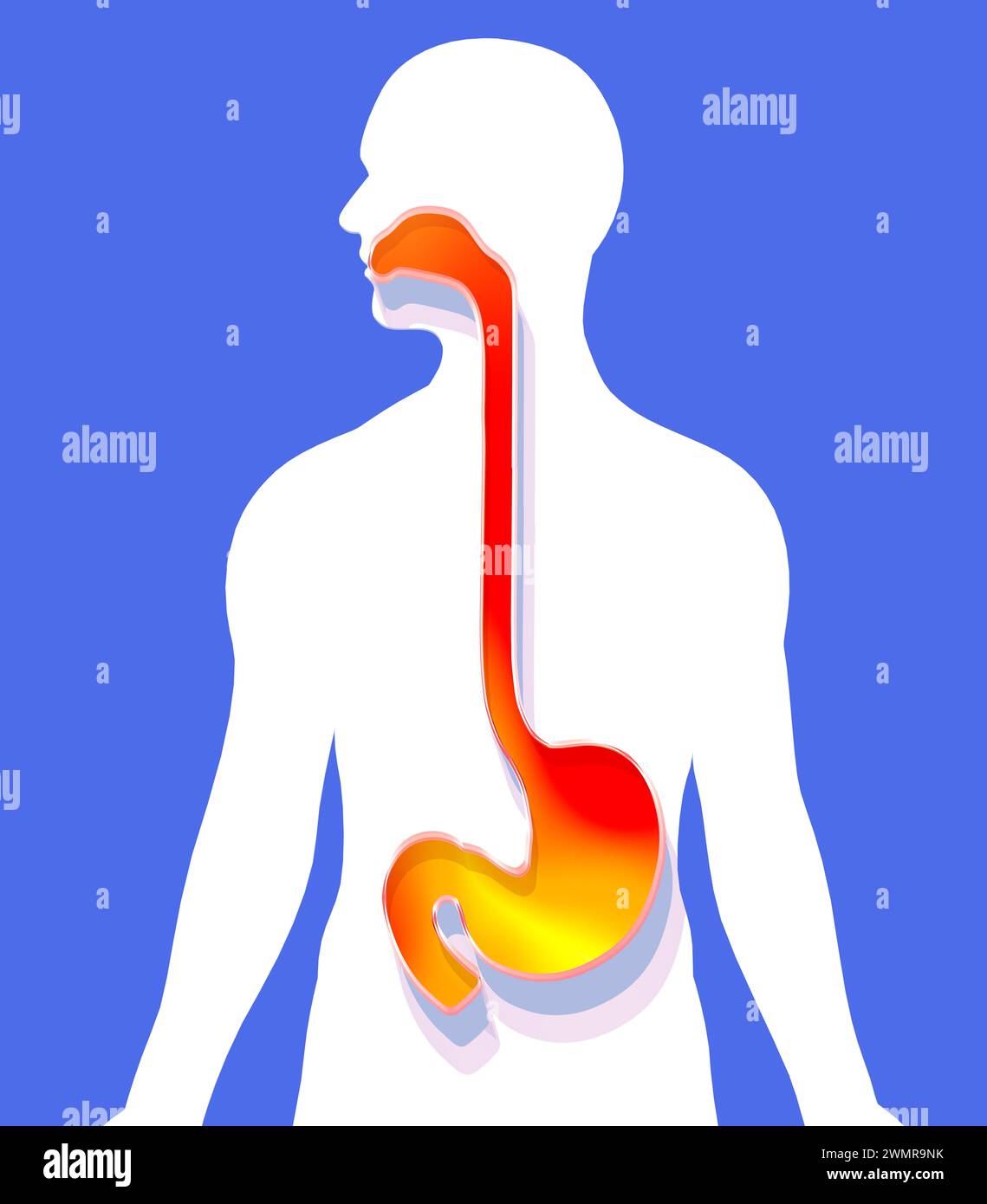 3d illustration of stomach and esophagus to the mouth with fire and indigestion. Showing ...