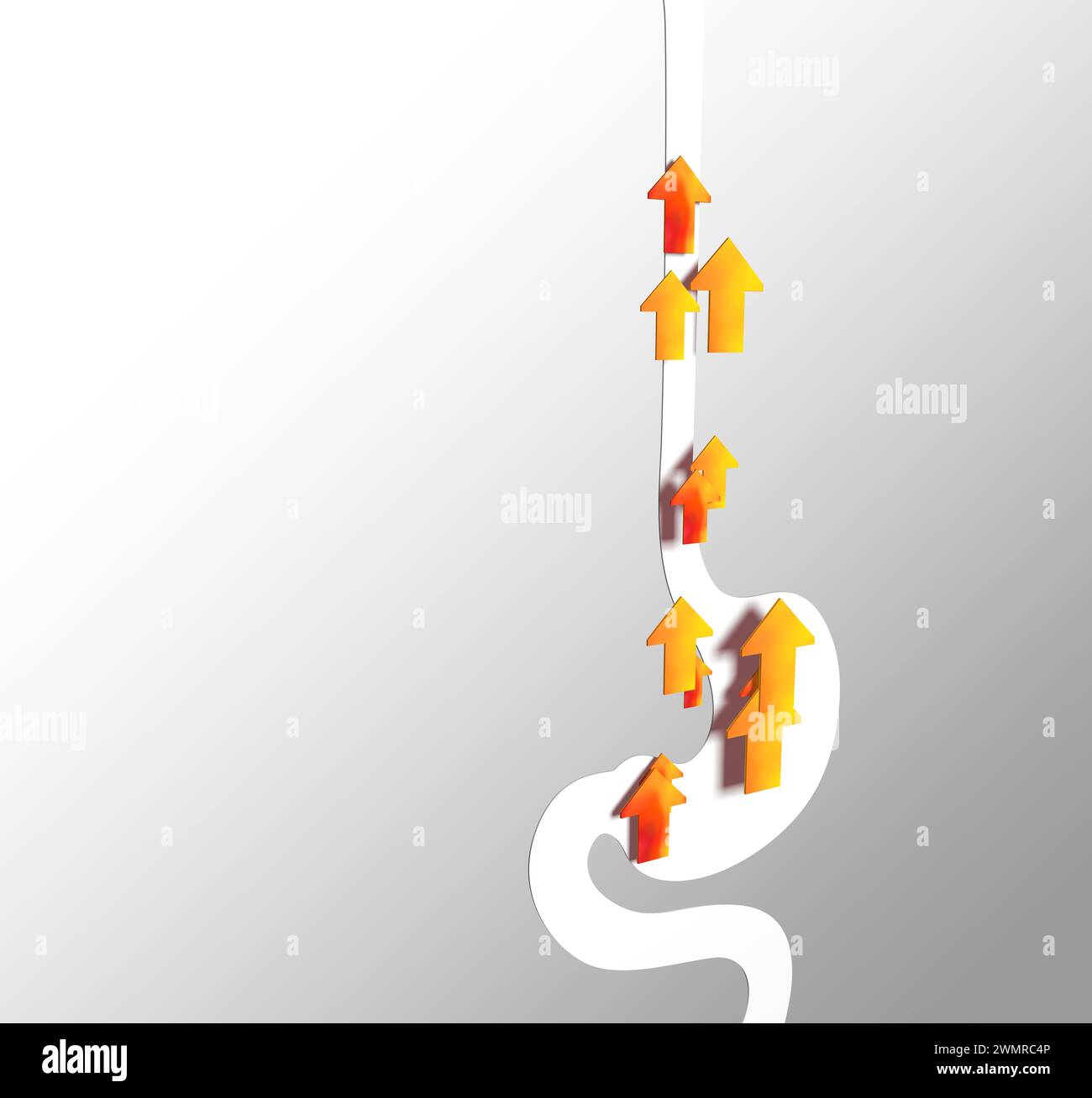 3d illustration of digestive system with gastric reflux and heartburn ...