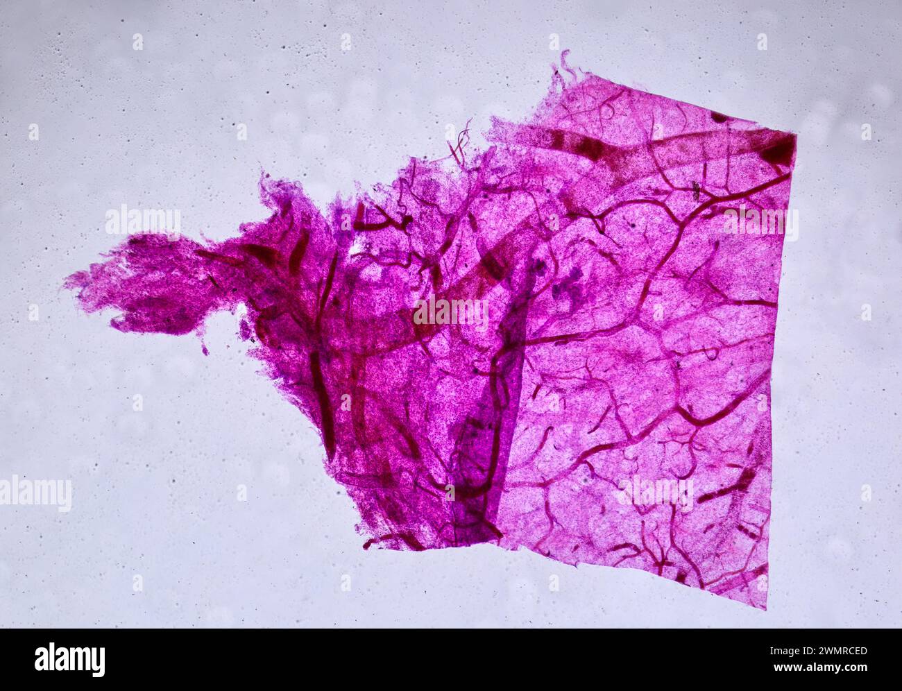 amazing inhabitants of the microworld under a microscope Stock Photo ...