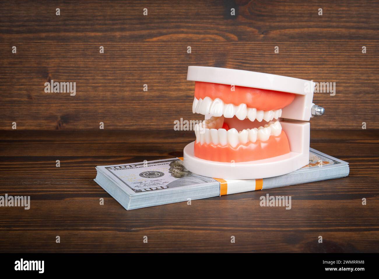 Banknotes in a pile, a model of teeth on top on wooden background ...