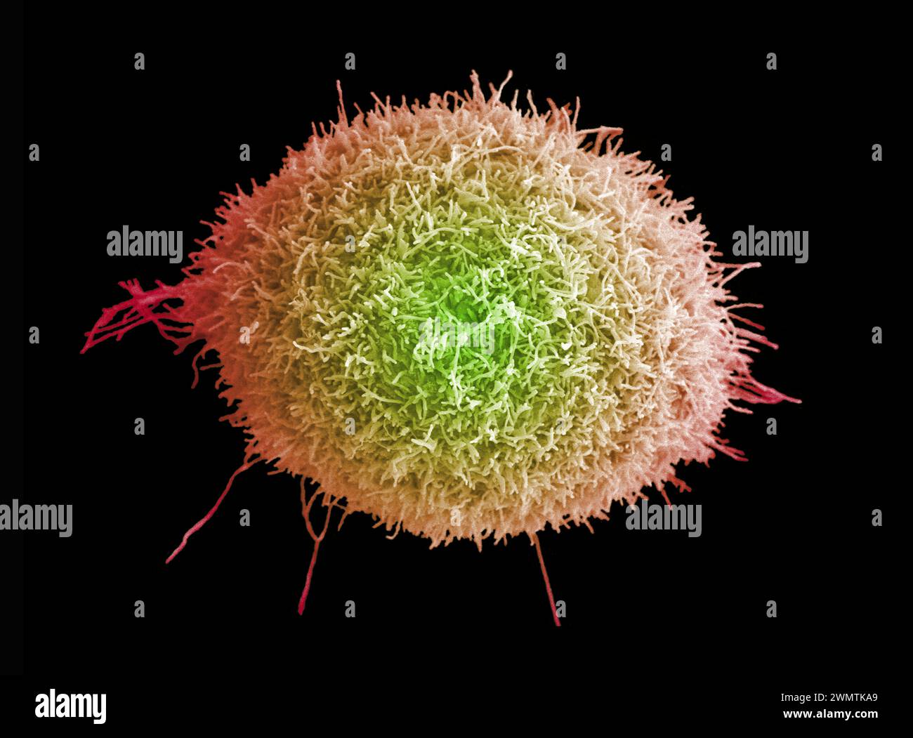 Cervical cancer cell, SEM Stock Photo - Alamy
