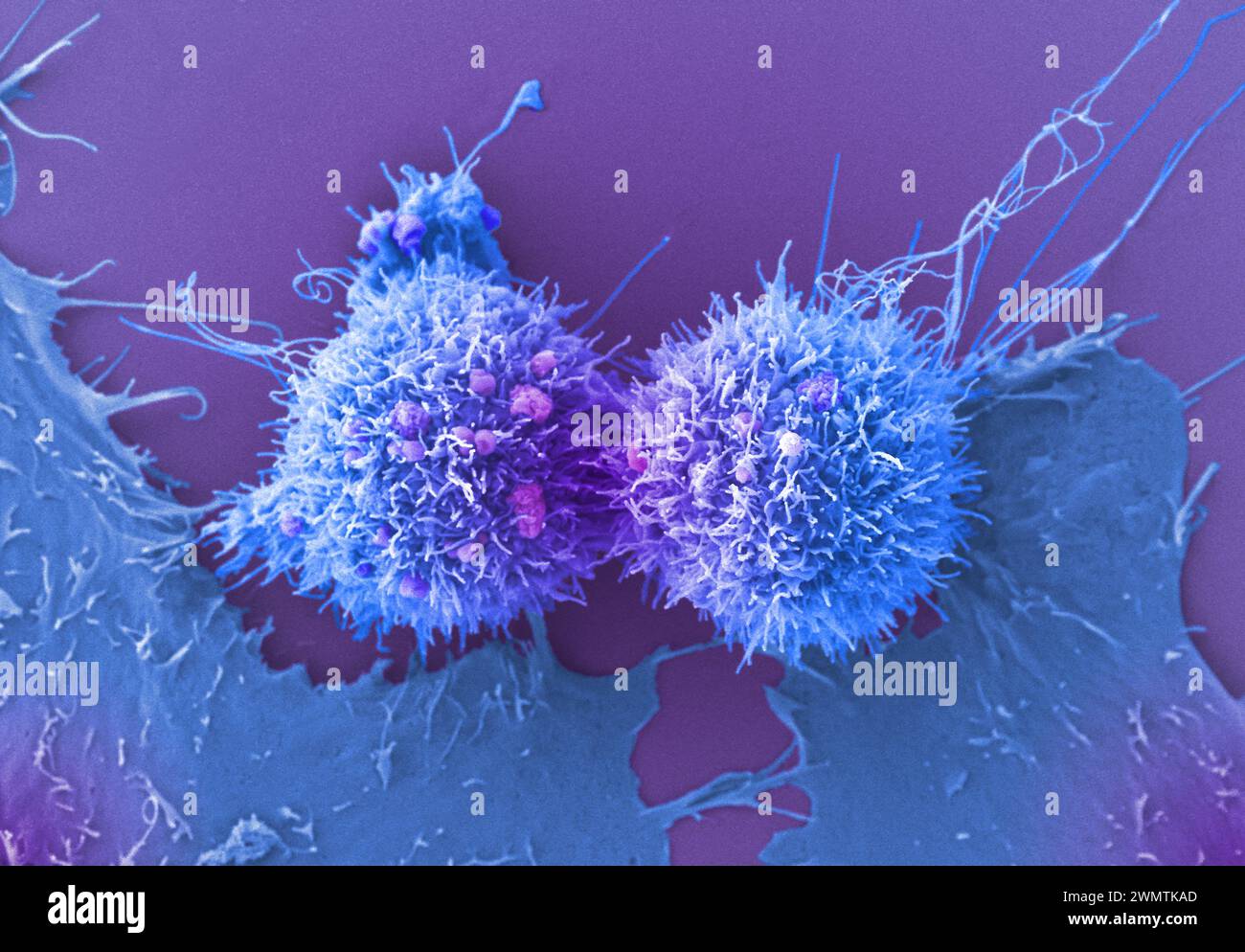 Cervical cancer cells dividing, SEM Stock Photo - Alamy