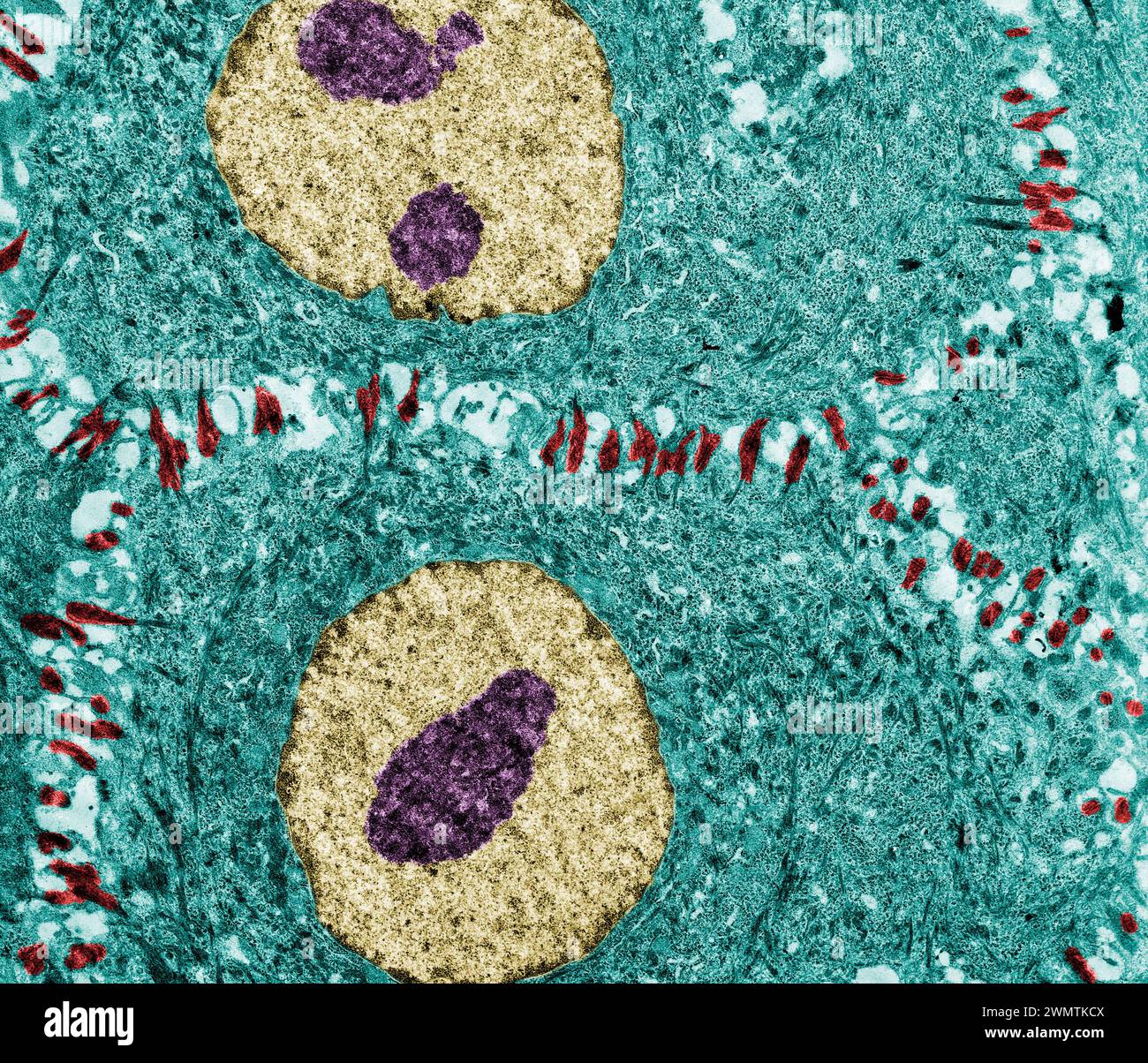 Desmosomes in epidermis, TEM Stock Photo - Alamy