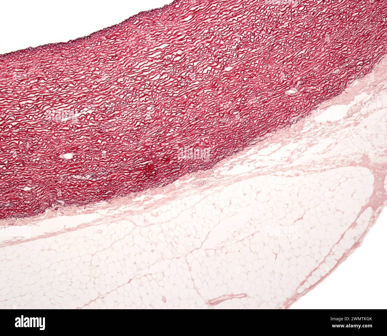 Elastic artery, light micrograph Stock Photo - Alamy