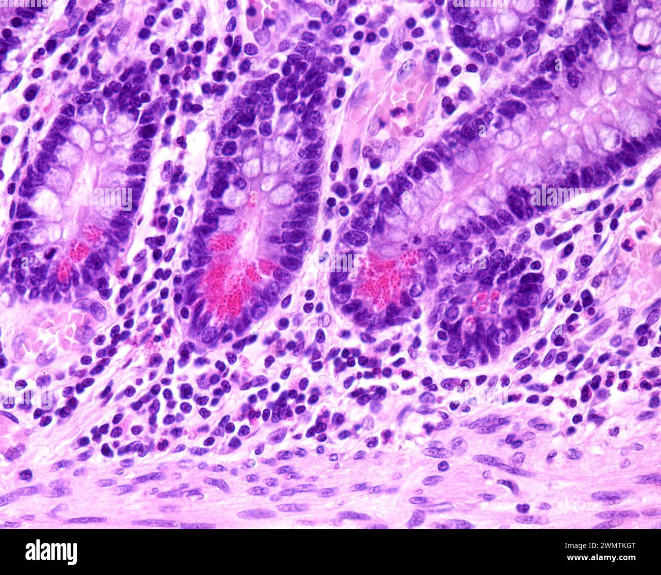 Small intestine Paneth cells, light micrograph Stock Photo - Alamy