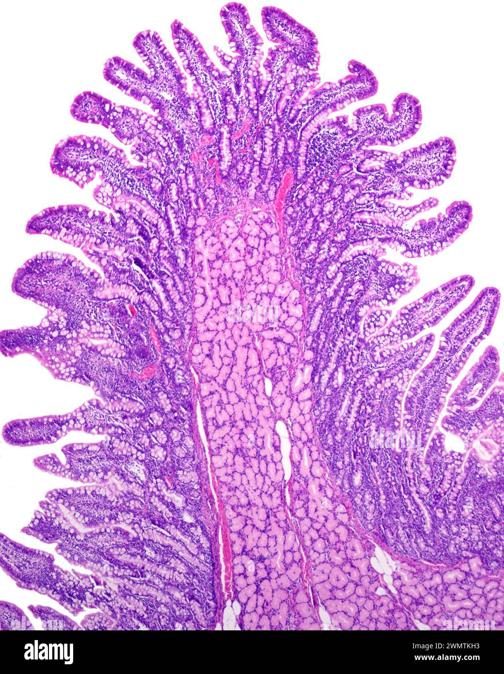 Brunner glands in duodenum, light micrograph Stock Photo - Alamy