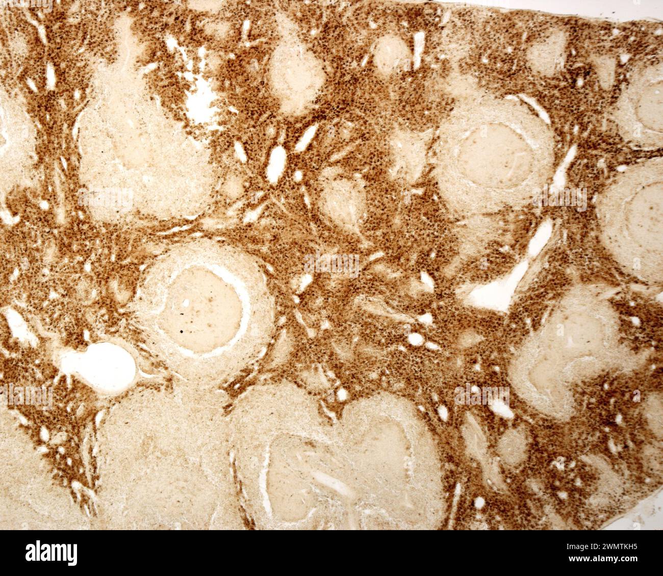 Spleen macrophages, light micrograph Stock Photo - Alamy