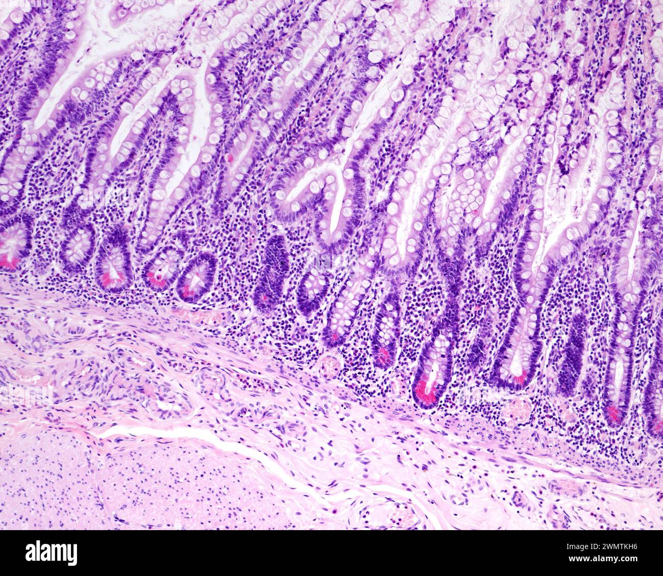 Small intestine Paneth cells, light micrograph Stock Photo - Alamy