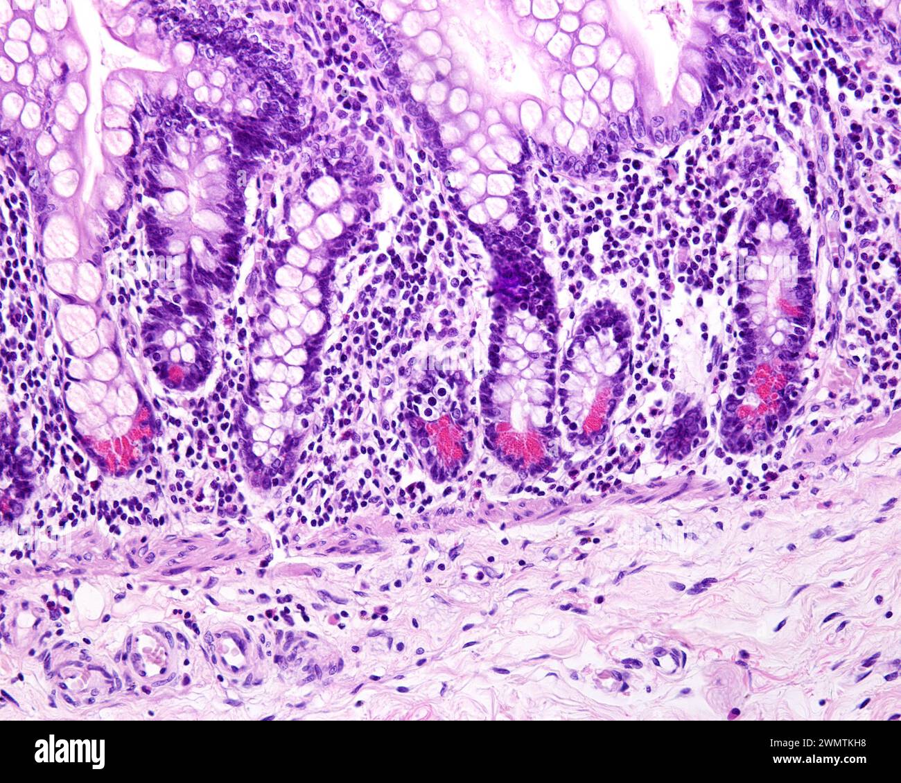 Small intestine Paneth cells, light micrograph Stock Photo - Alamy