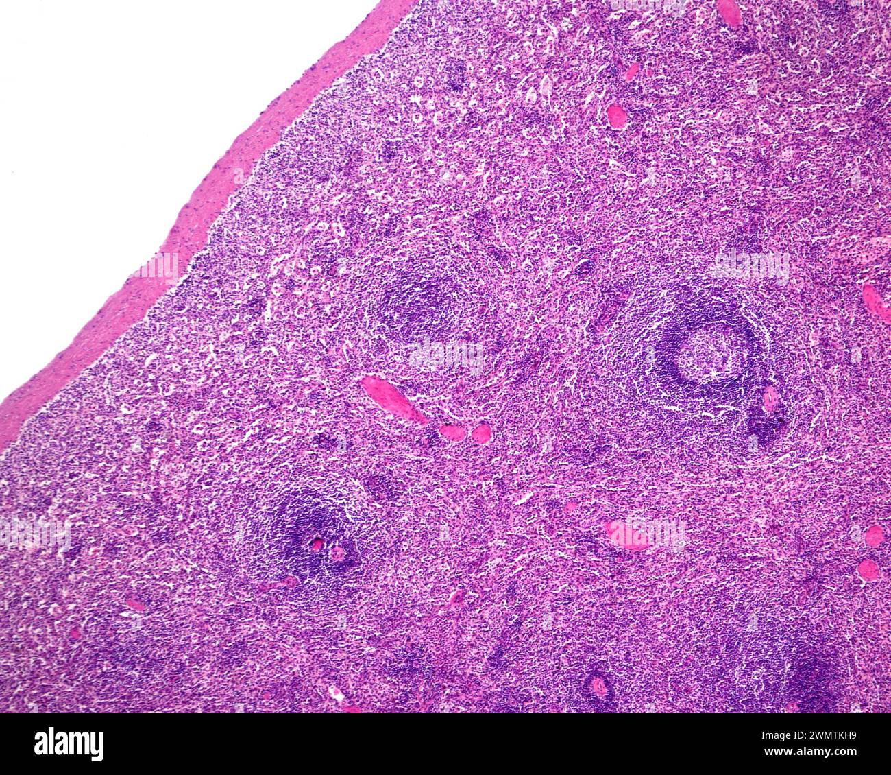 Human spleen, light micrograph Stock Photo - Alamy