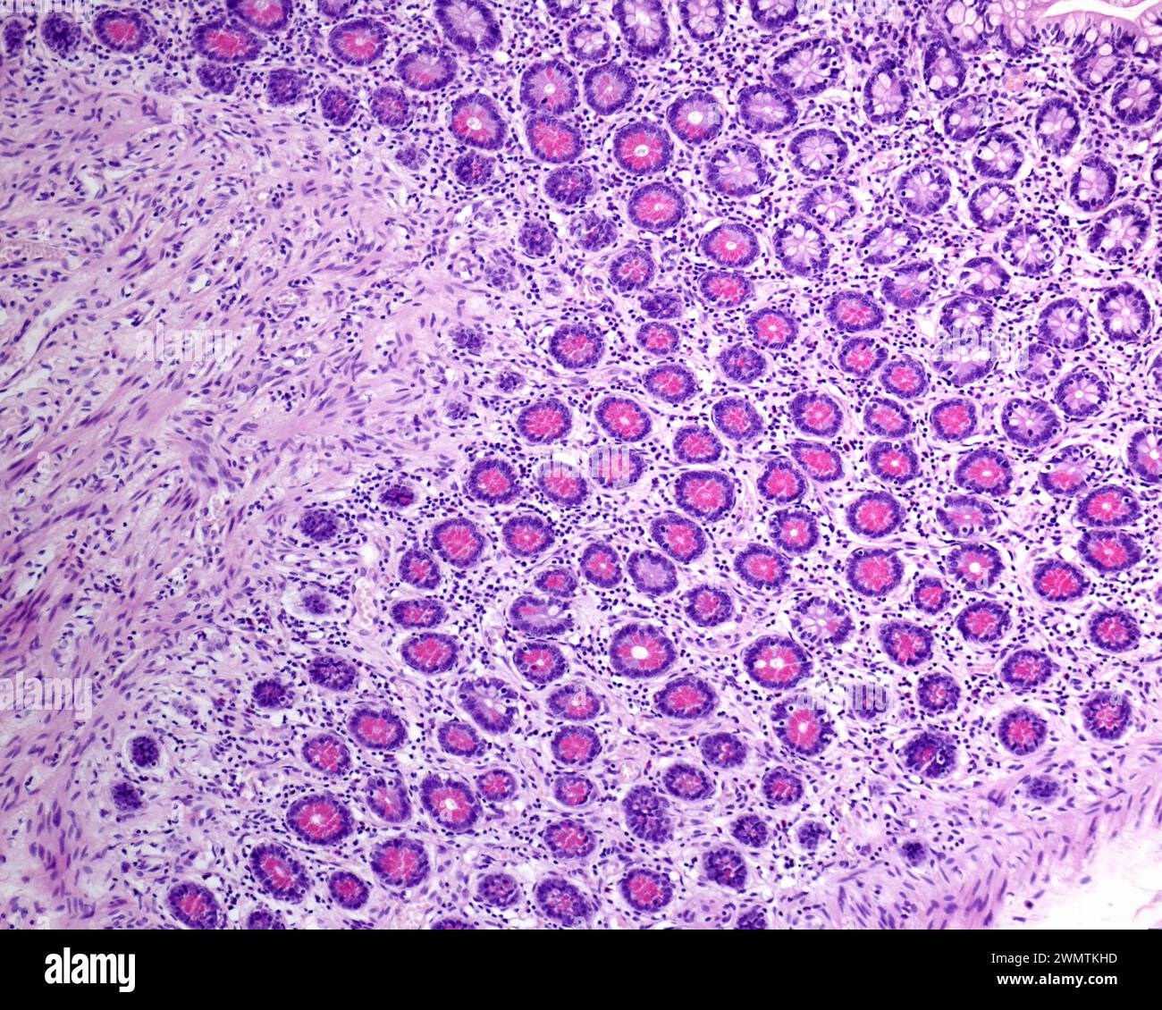 Small intestine Paneth cells, light micrograph Stock Photo - Alamy