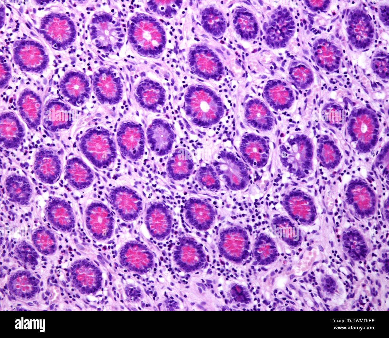 Small intestine Paneth cells, light micrograph Stock Photo - Alamy