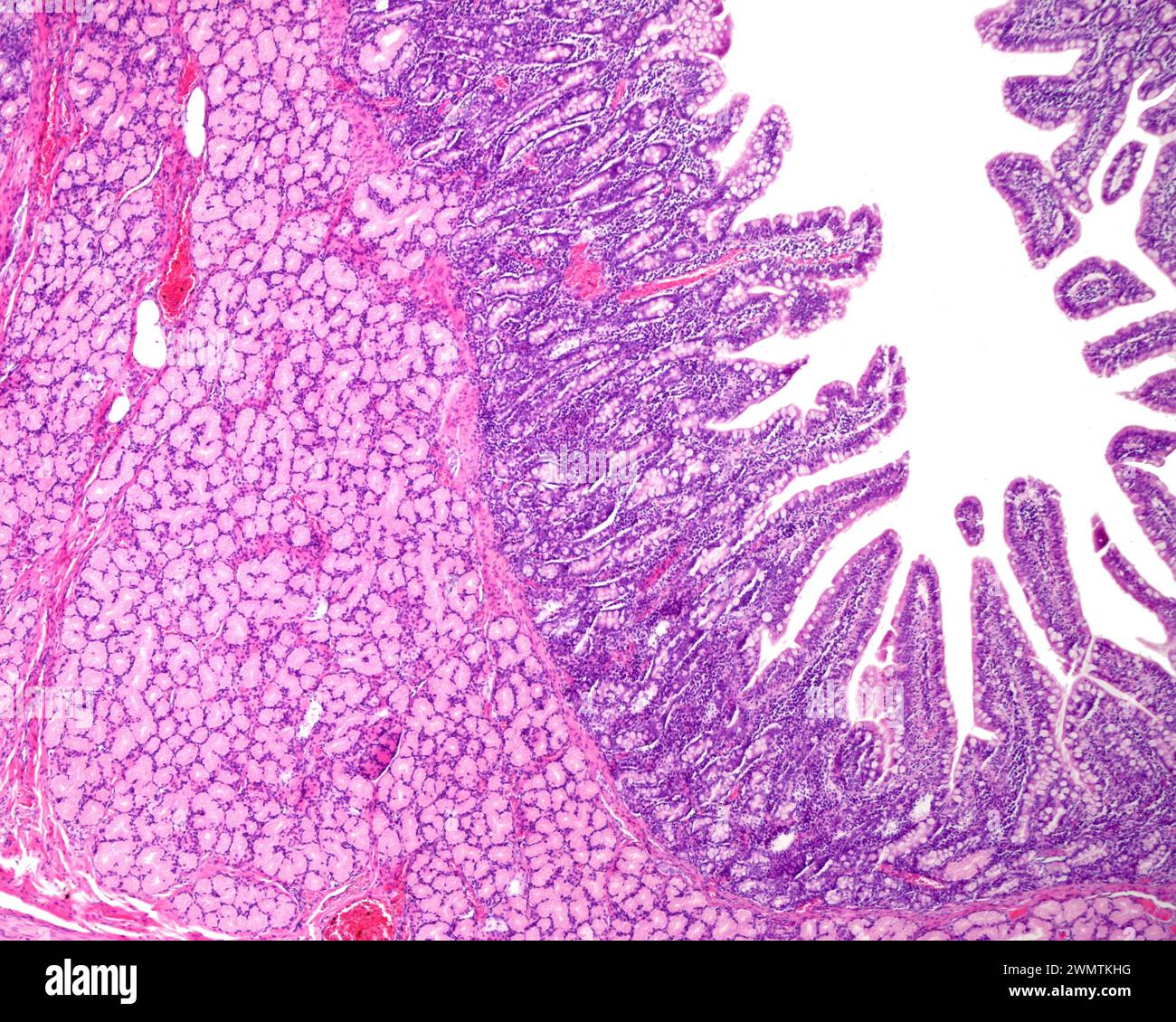 Brunner glands in duodenum, light micrograph Stock Photo - Alamy