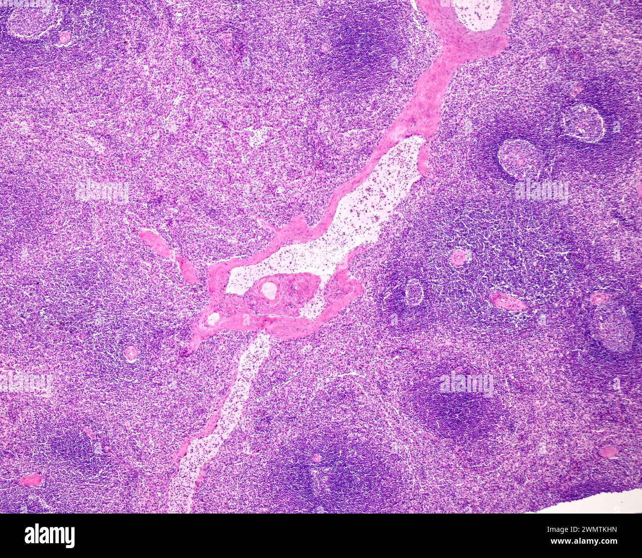Human spleen, light micrograph Stock Photo - Alamy
