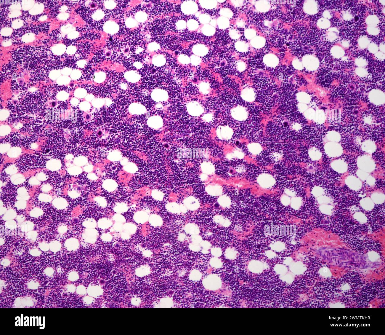 Bone marrow, light micrograph Stock Photo - Alamy