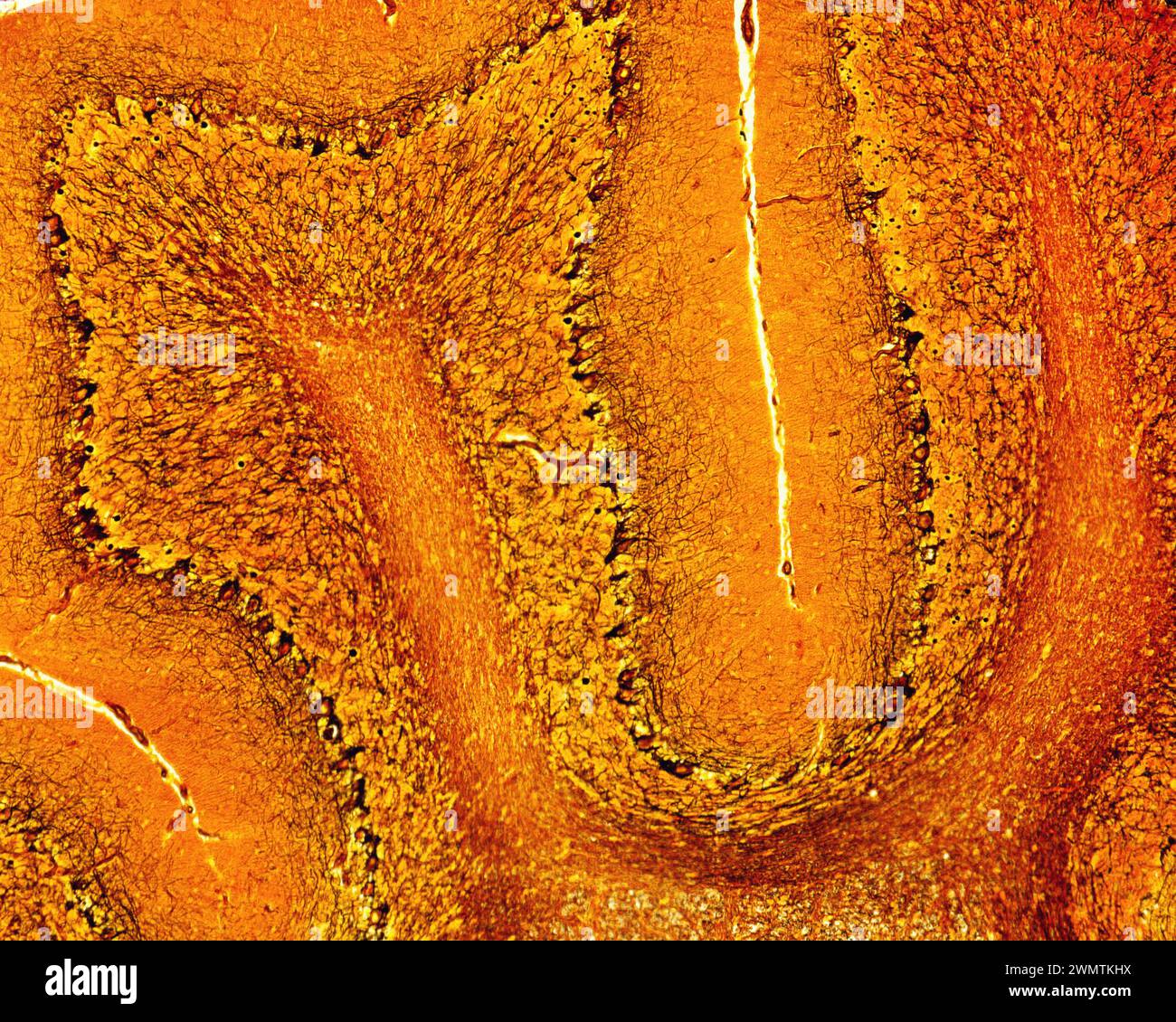 Cerebellar cortex, light micrograph Stock Photo - Alamy
