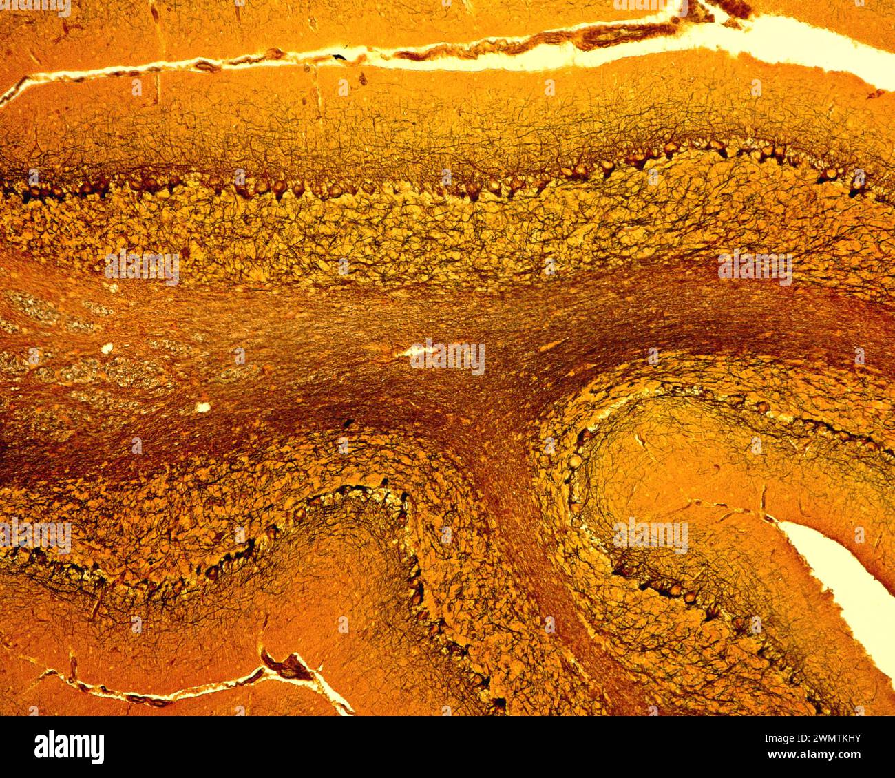 Cerebellar cortex, light micrograph Stock Photo - Alamy