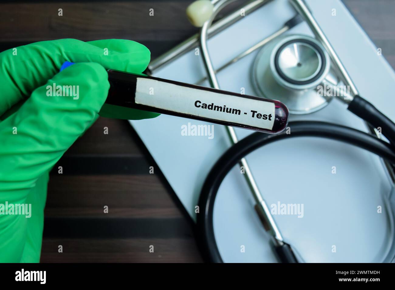 Mercury atom hi-res stock photography and images - Alamy