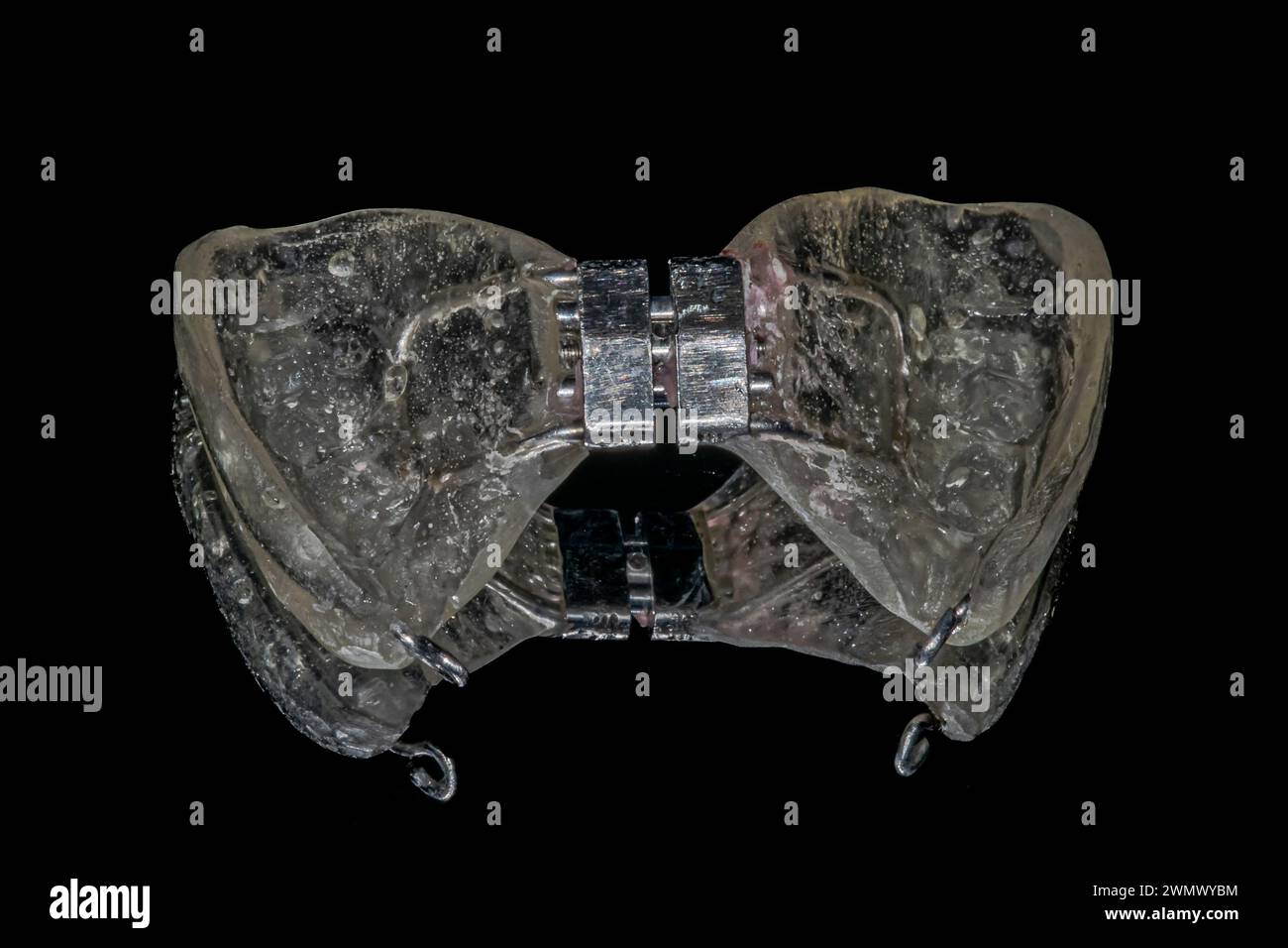 Palatal expander orthodontics device to widen the maxilla, made of ...