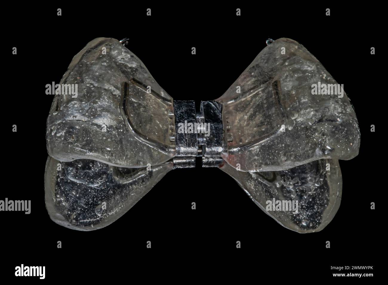 Palatal expander orthodontics device to widen the maxilla, made of ...
