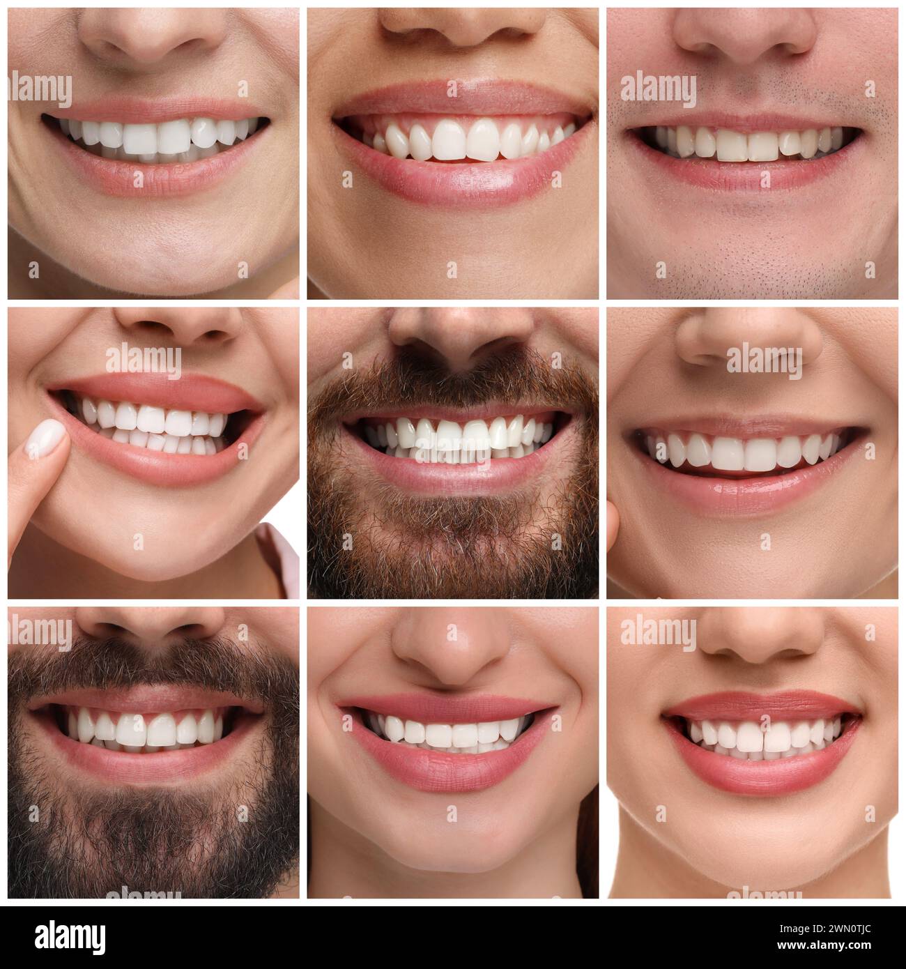People showing white teeth, closeup. Collage of photos Stock Photo - Alamy