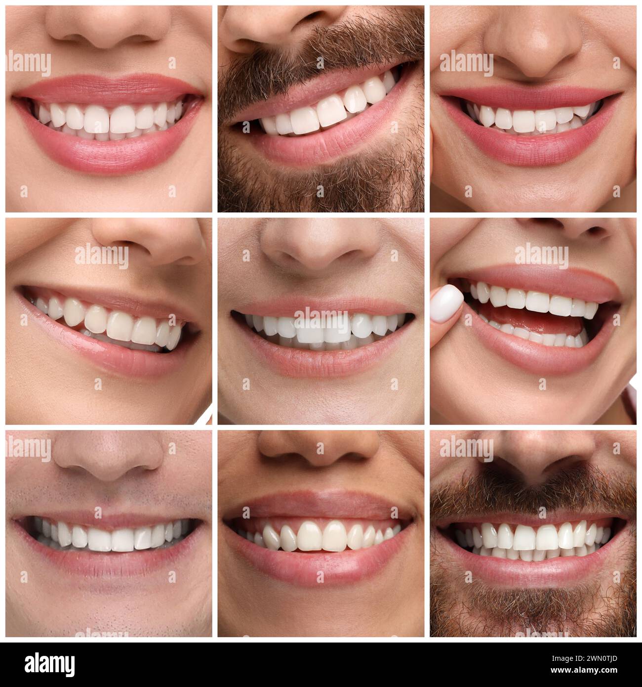 People showing white teeth, closeup. Collage of photos Stock Photo - Alamy