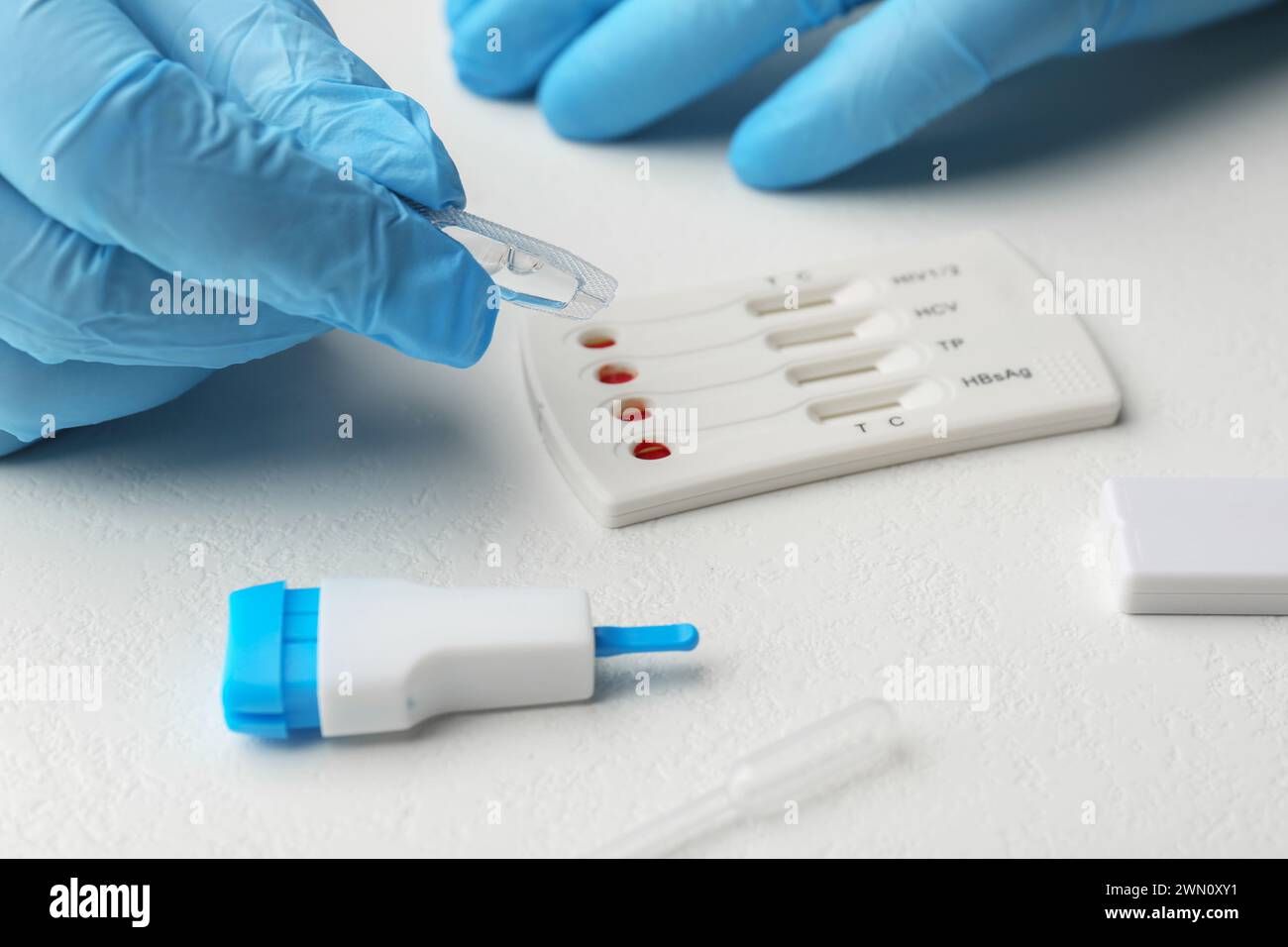 Doctor dropping buffer solution onto disposable multi-infection express ...