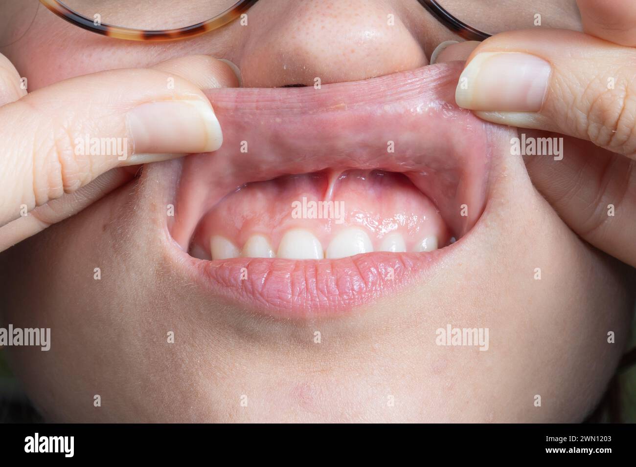 Close-up shot of a person's open mouth, displaying healthy teeth and ...