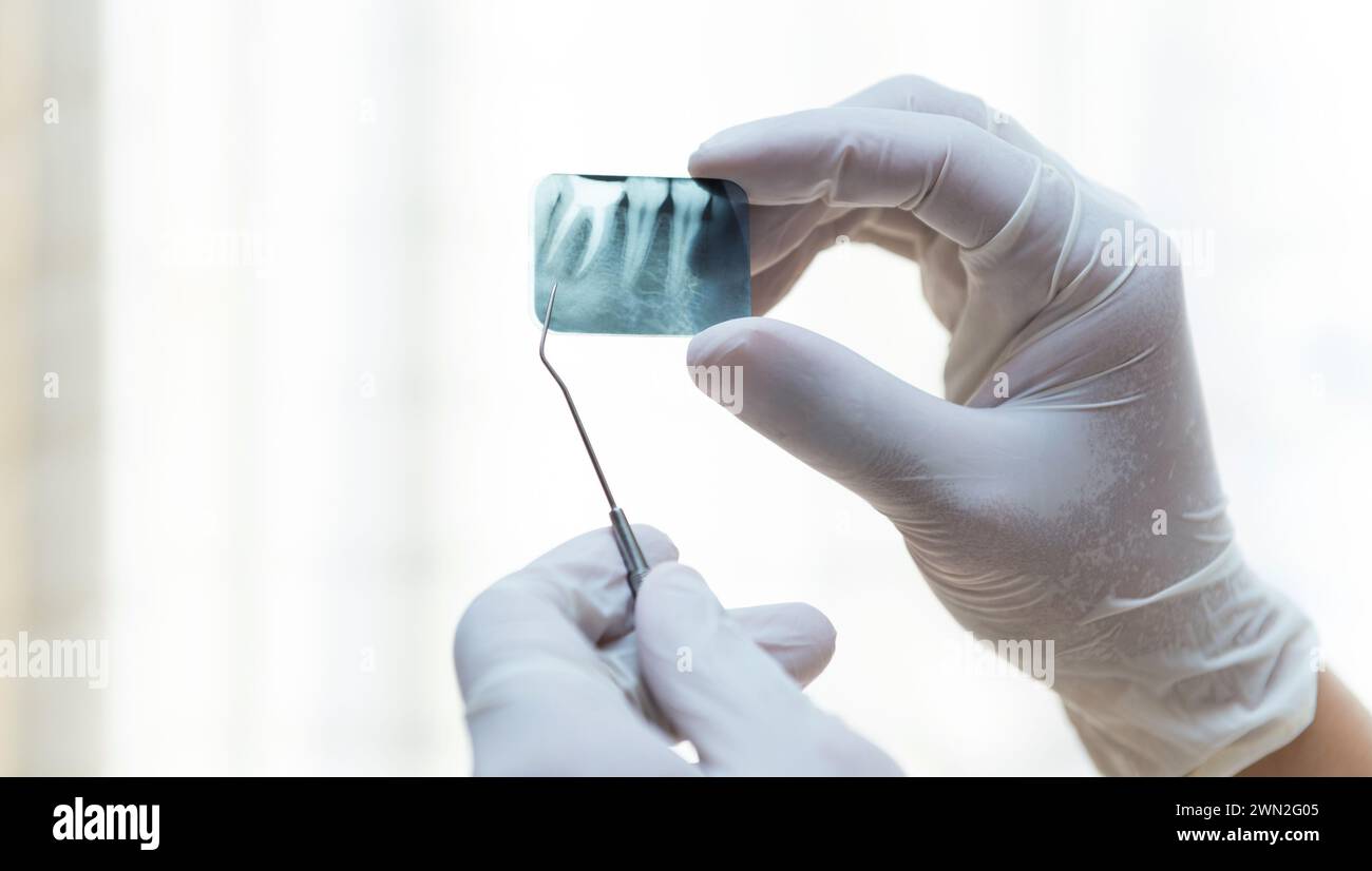 Tooth x-ray being examined by a dentist Stock Photo - Alamy