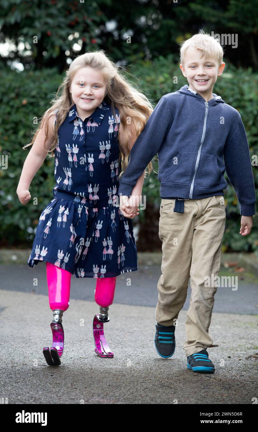 17/12/14 Grace's brother, Thomas (9) helps Grace to walk wearing her ...