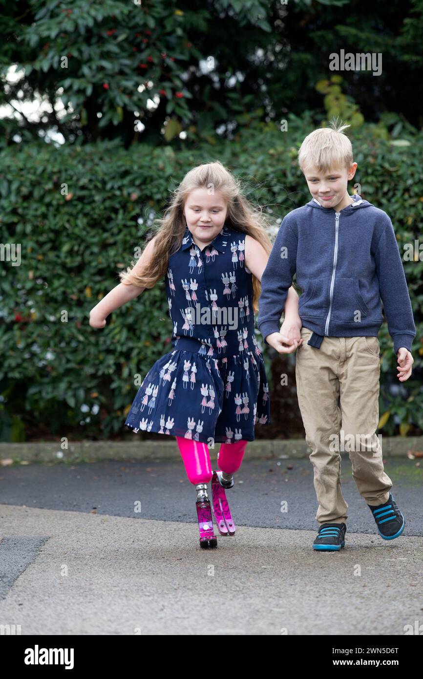 17/12/14 Grace's brother, Thomas (9) helps Grace to walk wearing her ...