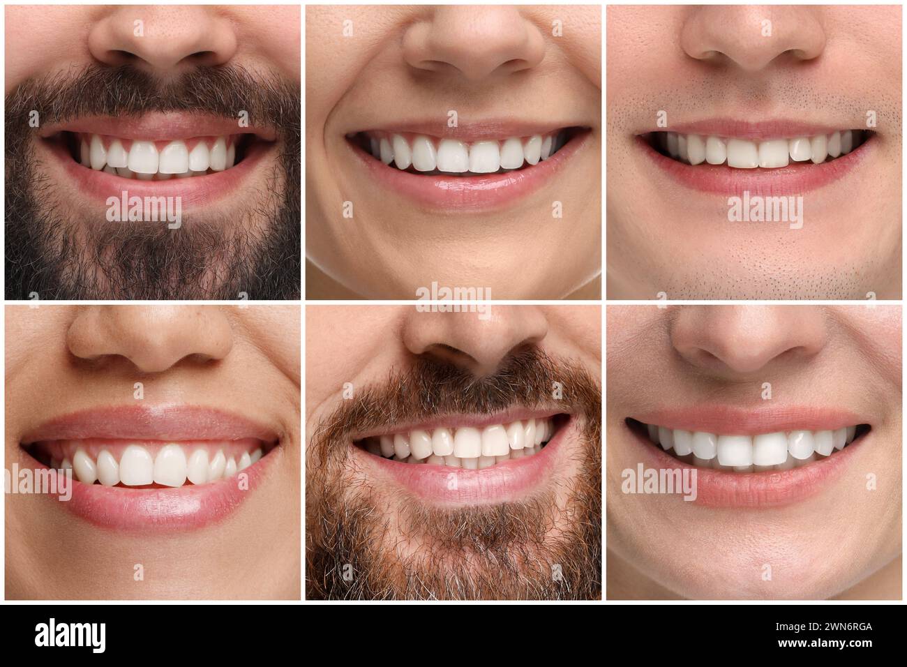 People showing white teeth, closeup. Collage of photos Stock Photo - Alamy