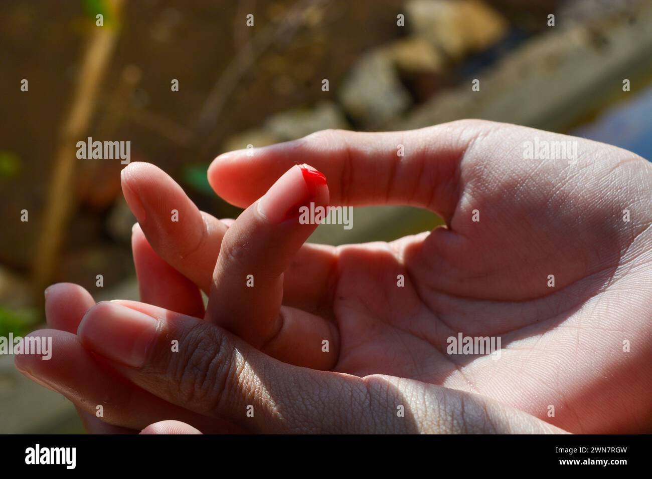 Photo of a finger cut, cut by a knife, bleeding fresh red blood Stock ...