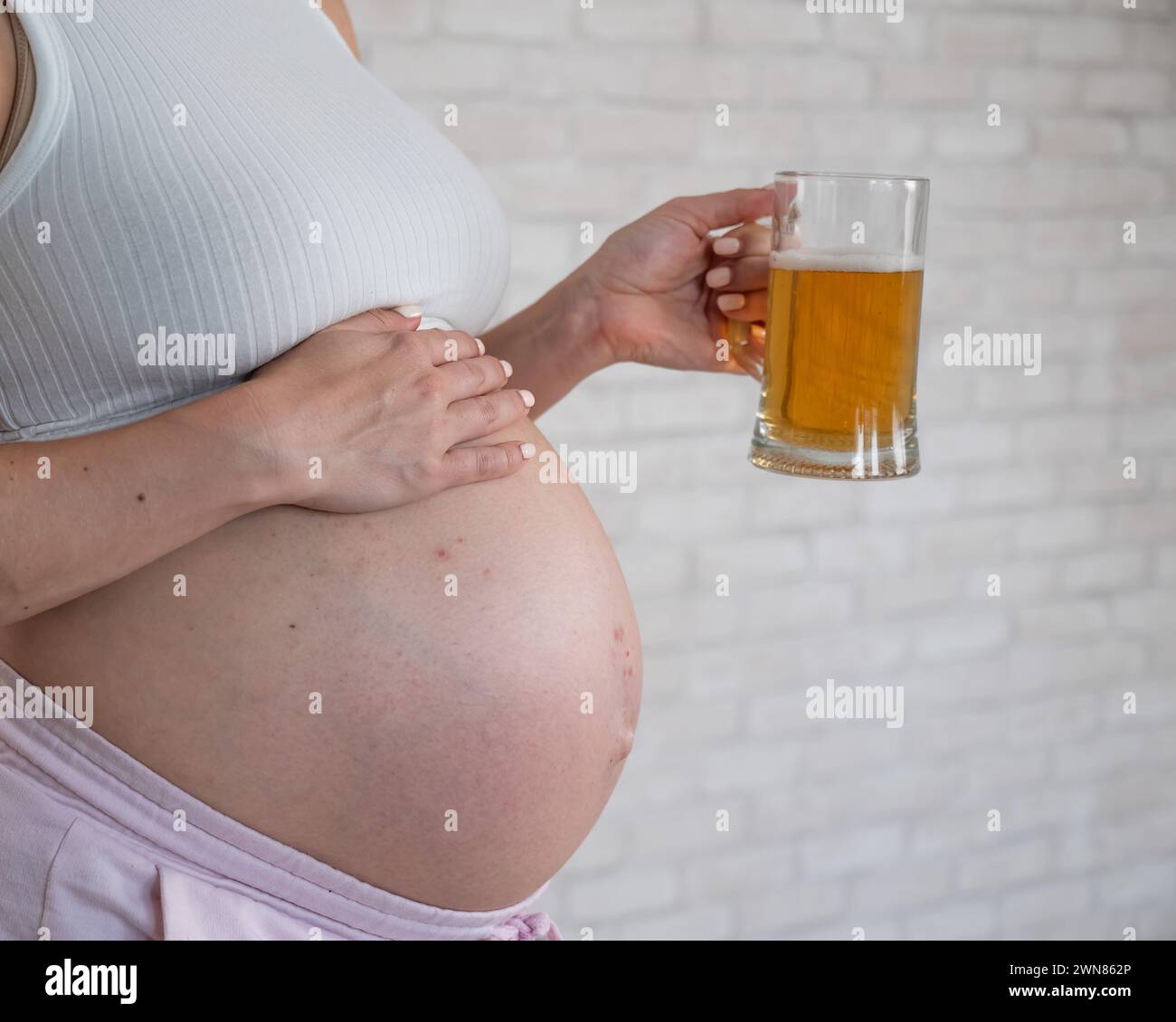 Faceless pregnant woman with rash on stomach holding glass of beer ...
