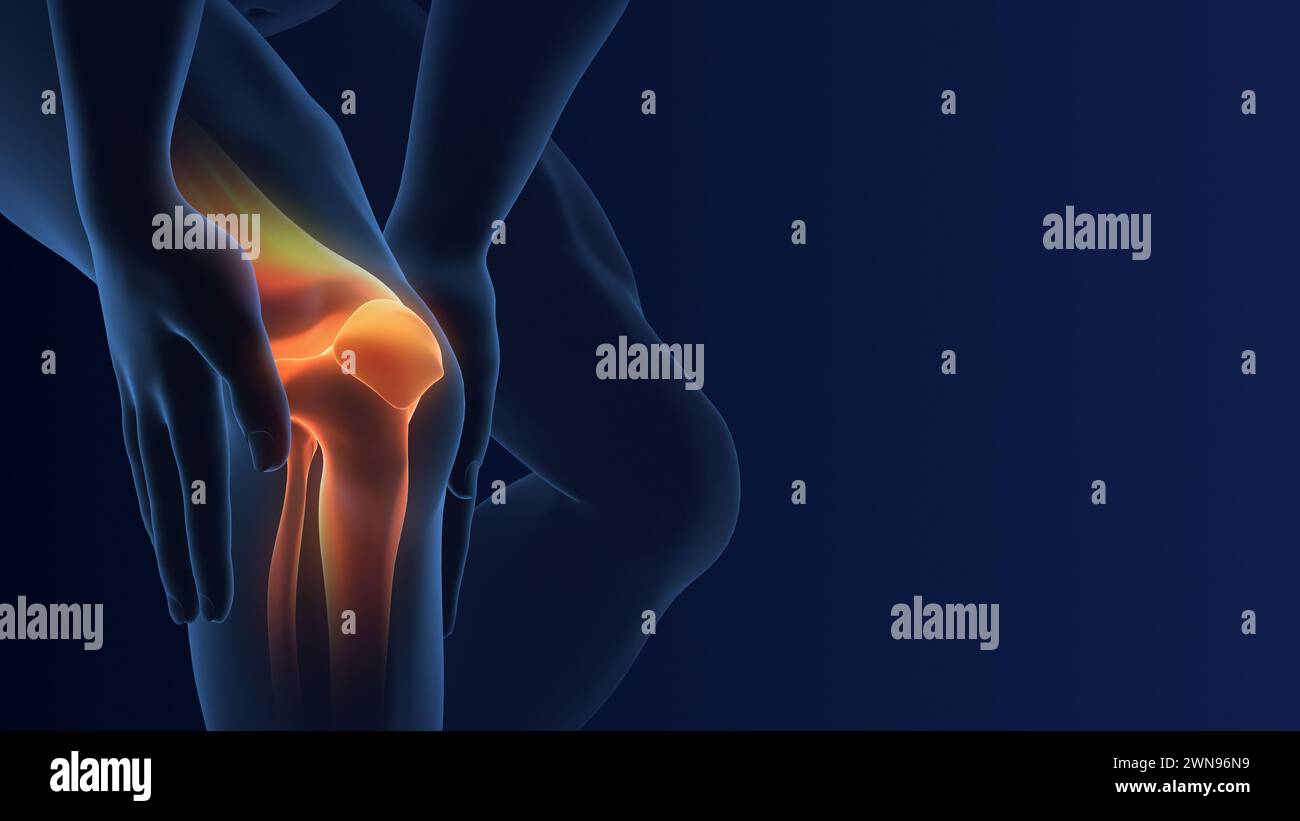 Medical Concept of Knee joint pain Stock Photo - Alamy