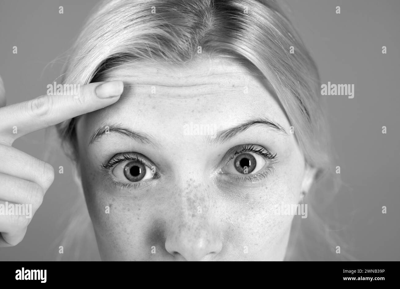 First wrinkles. Woman wondering face show wrinkles on forehead. Skin ...