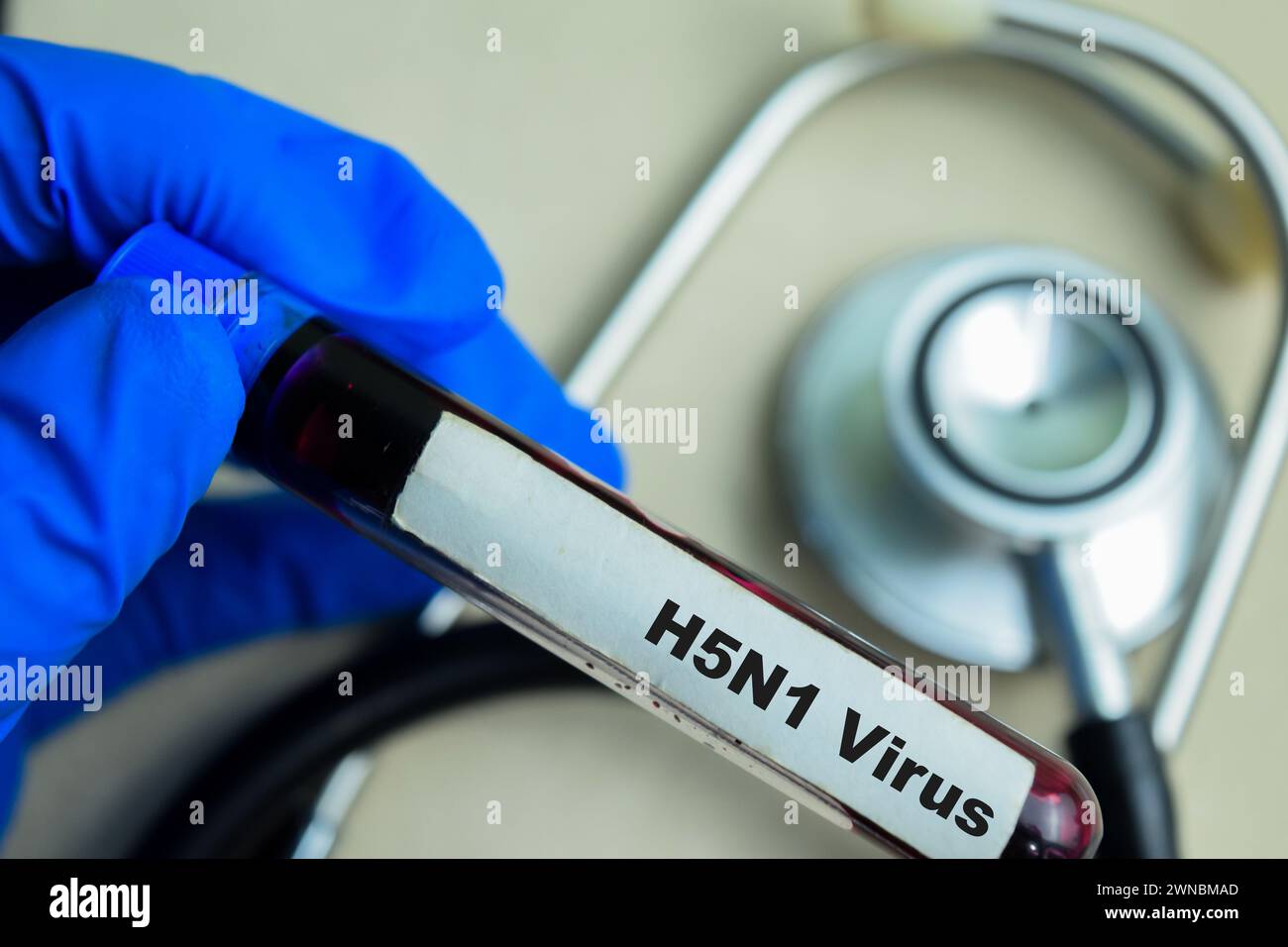 Poultry vaccination hi-res stock photography and images - Alamy