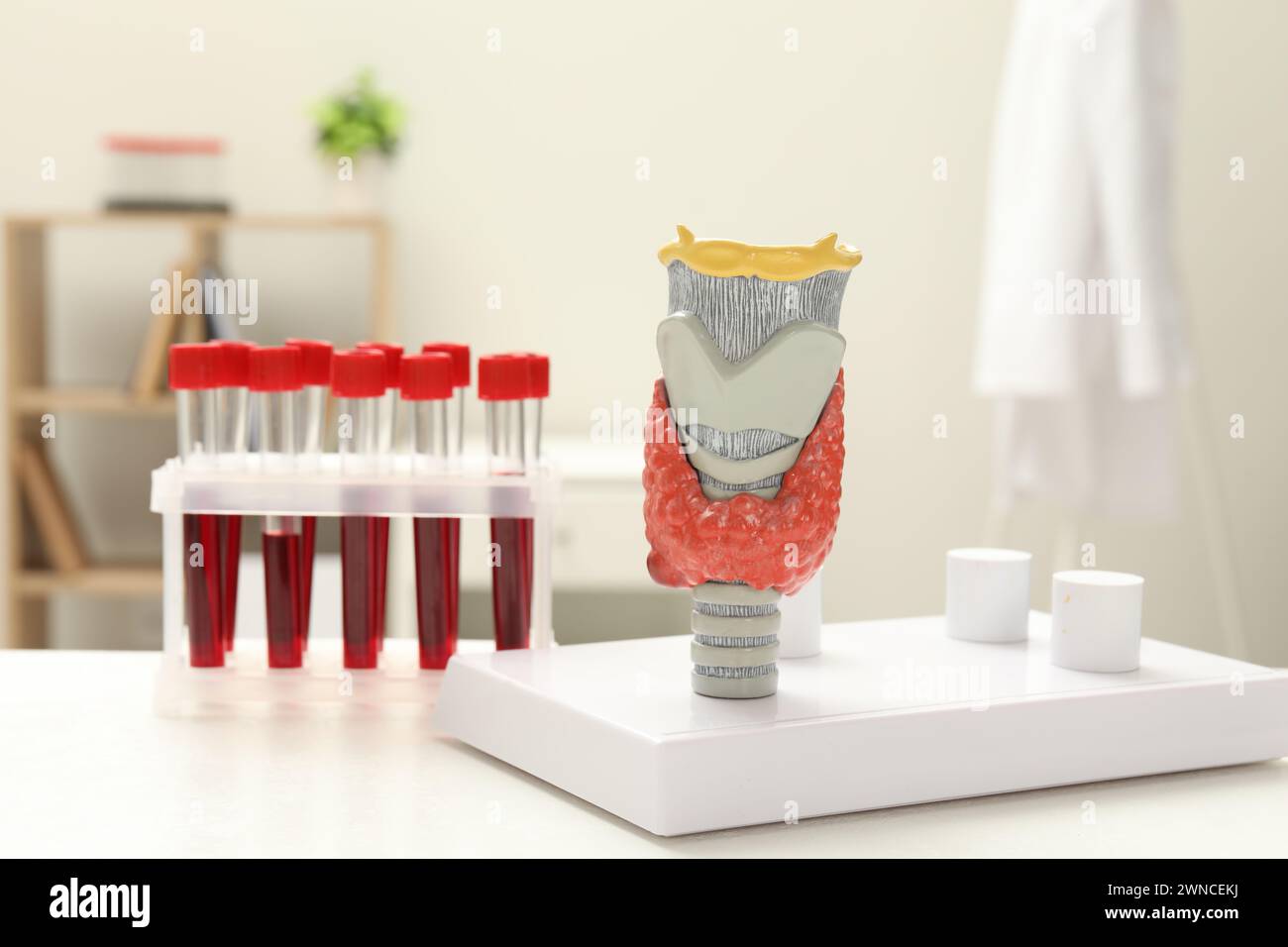 Endocrinology. Model of thyroid gland and samples of blood in test ...