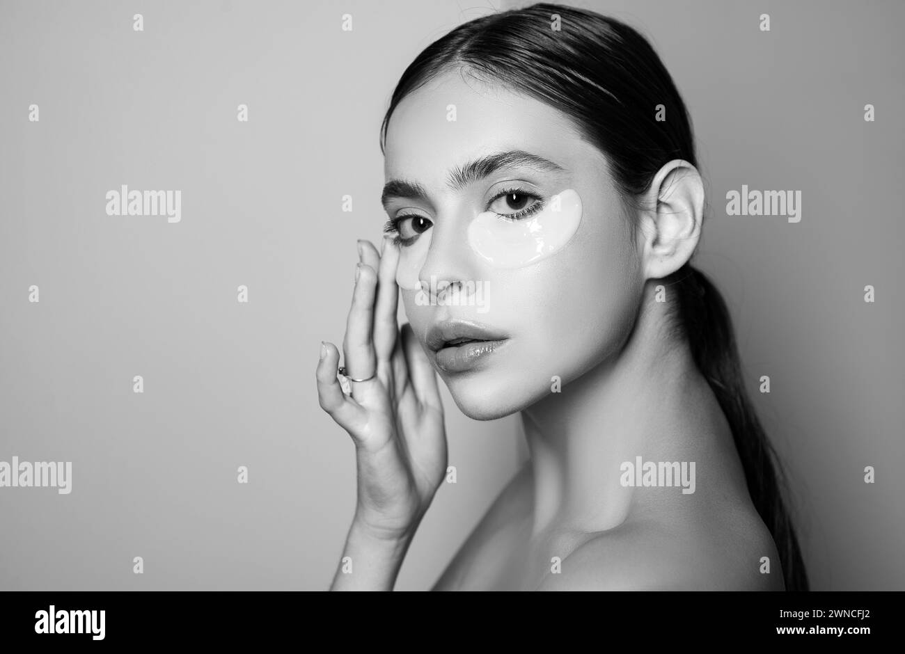 Beauty girl face with flakes under the eyes. Womans flakes. Patches ...