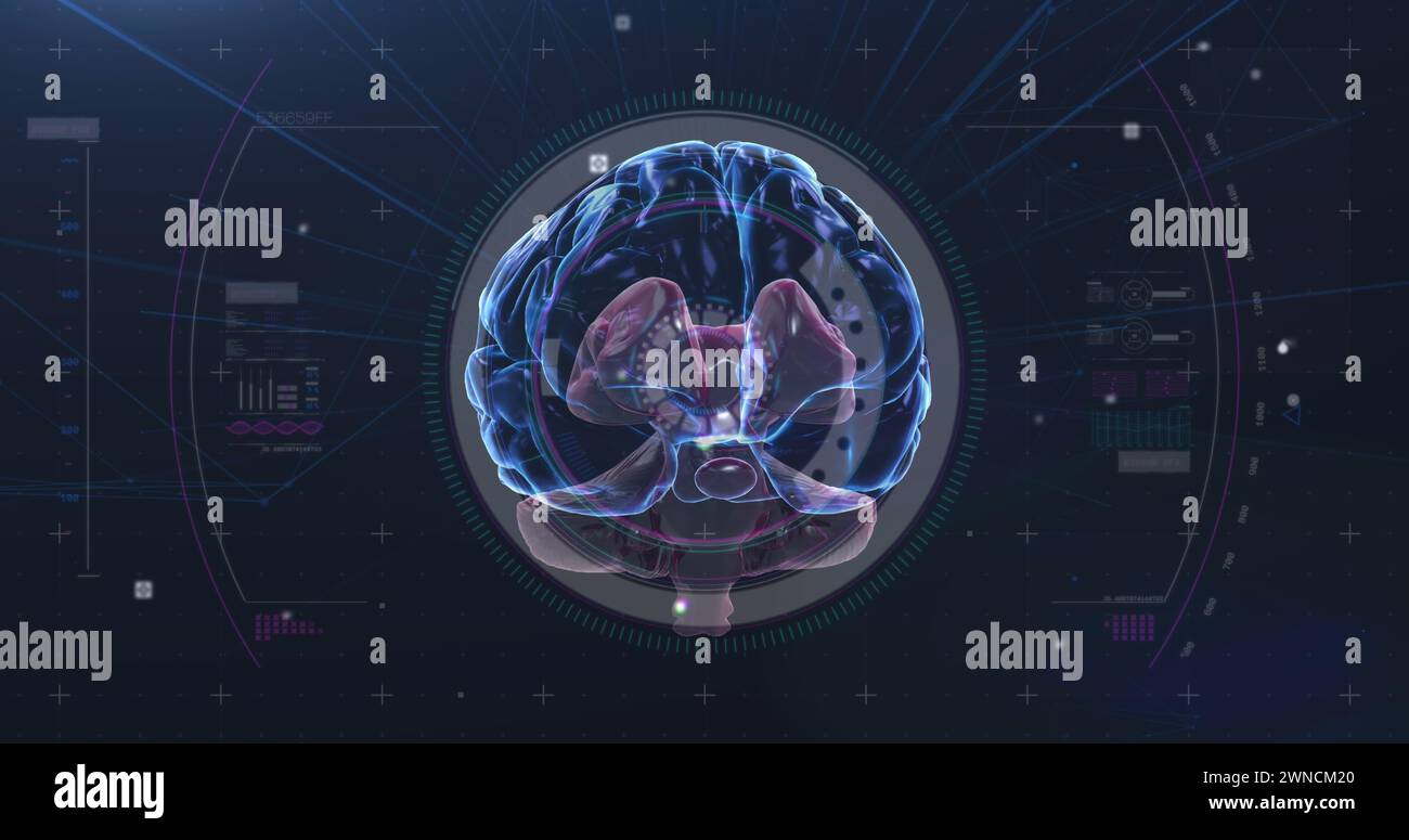 Image of scope scanning with human brain spinning on black background Stock Photo - Alamy