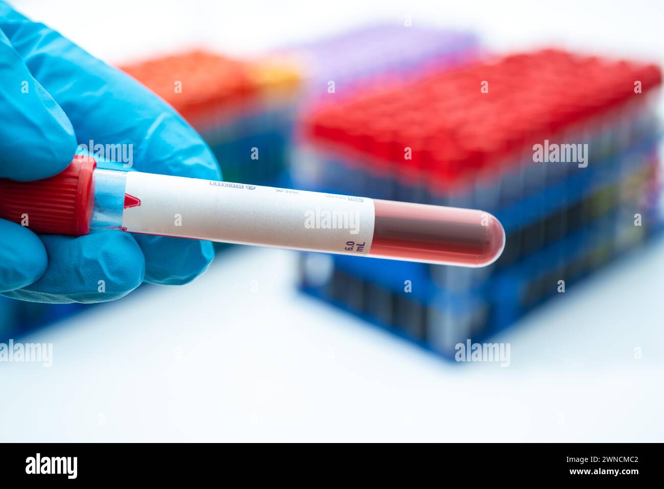 Medical test tube with blood sample Stock Photo - Alamy