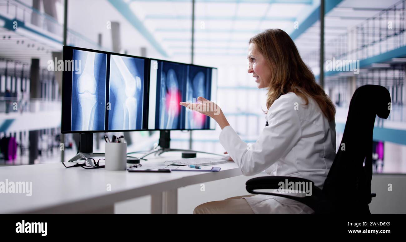 Doctor Screening Knee Bone X Ray On Computer Stock Photo - Alamy