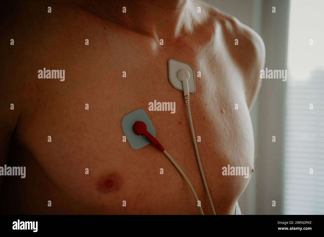 Cardio health revealed: Natural light illuminates the intricate ...