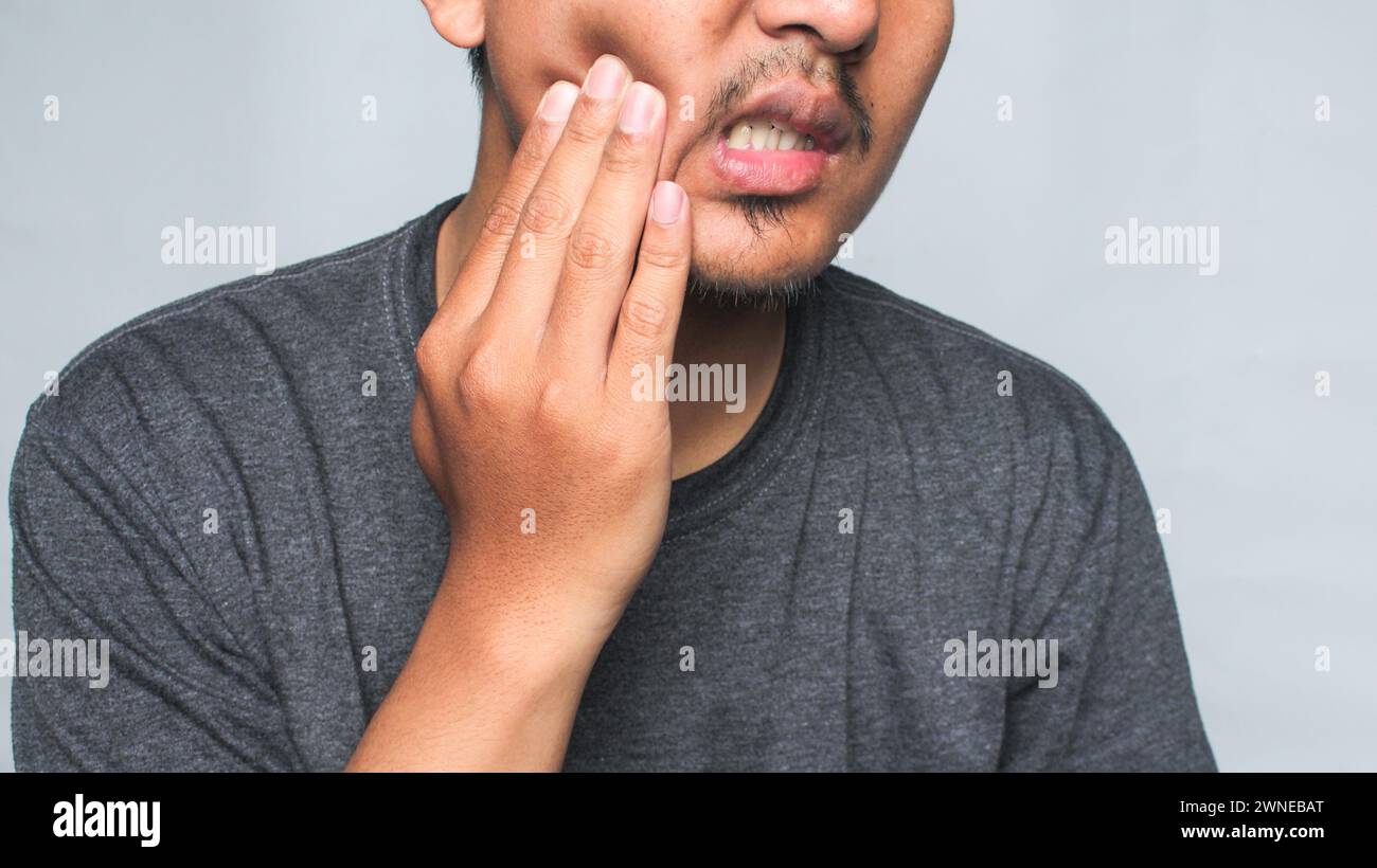 Damaged tooth with cavity dental caries decay Stock Photo - Alamy