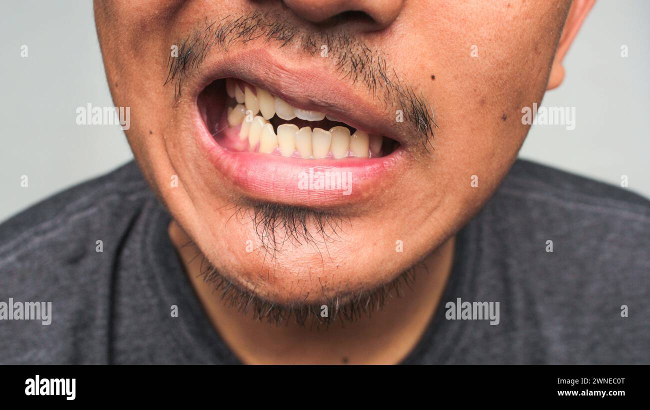 Bell's palsy is a condition that causes sudden weakness in the muscles ...