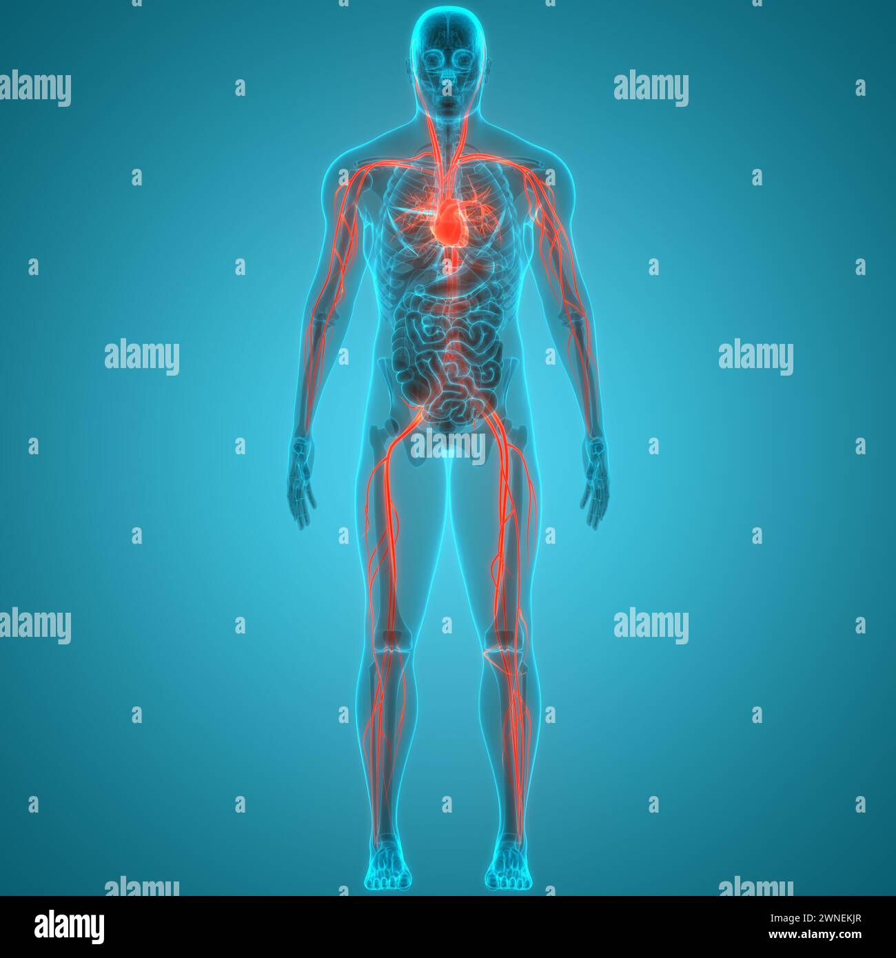 Angina x ray hi-res stock photography and images - Alamy