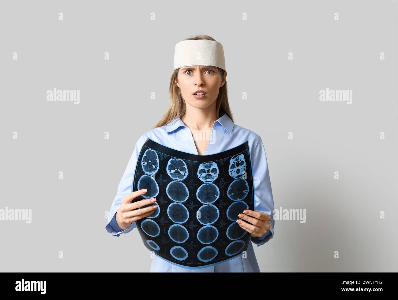 Young woman with brain concussion and MRI scan on light background ...